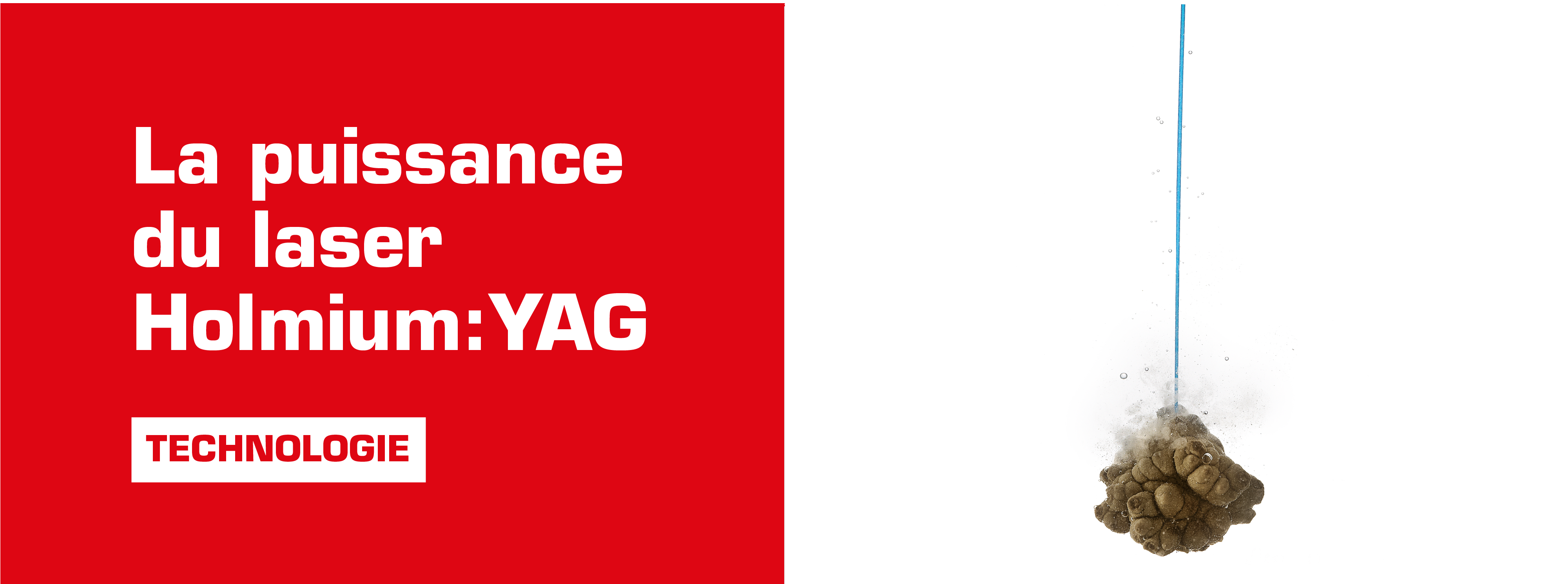 La puissance du laser Holmuim:YAG | EMS Urology